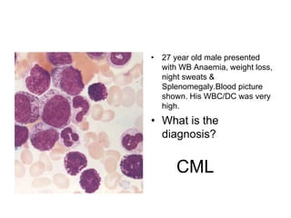 Clinical pathology spots for final MBBS | PDF