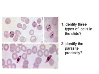 Clinical pathology spots for final MBBS | PDF