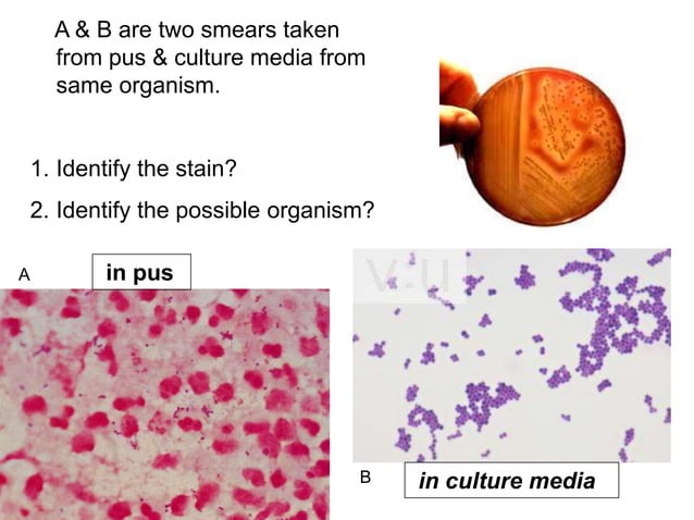 Clinical pathology spots for final MBBS | PDF