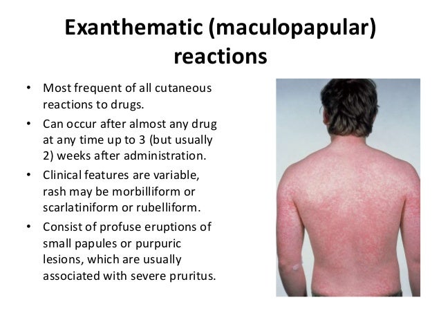 Clinical patterns of adverse drug reactions ppt