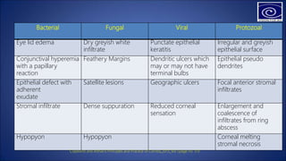 Clinical pearls (Anterior Segment) | PPTX