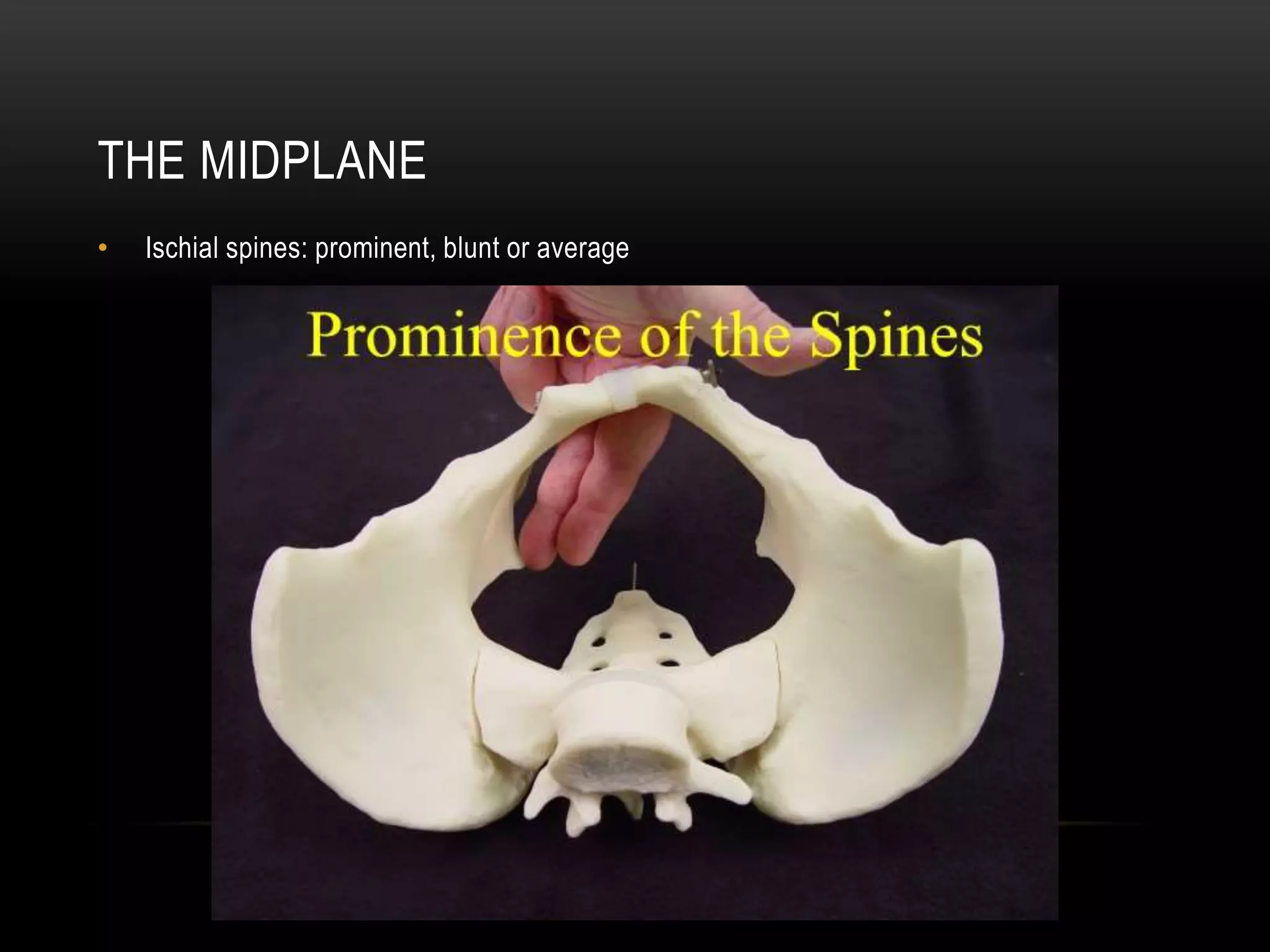 Clinical pelvimetry and Forceps Assisted Vaginal Delivery | PPT