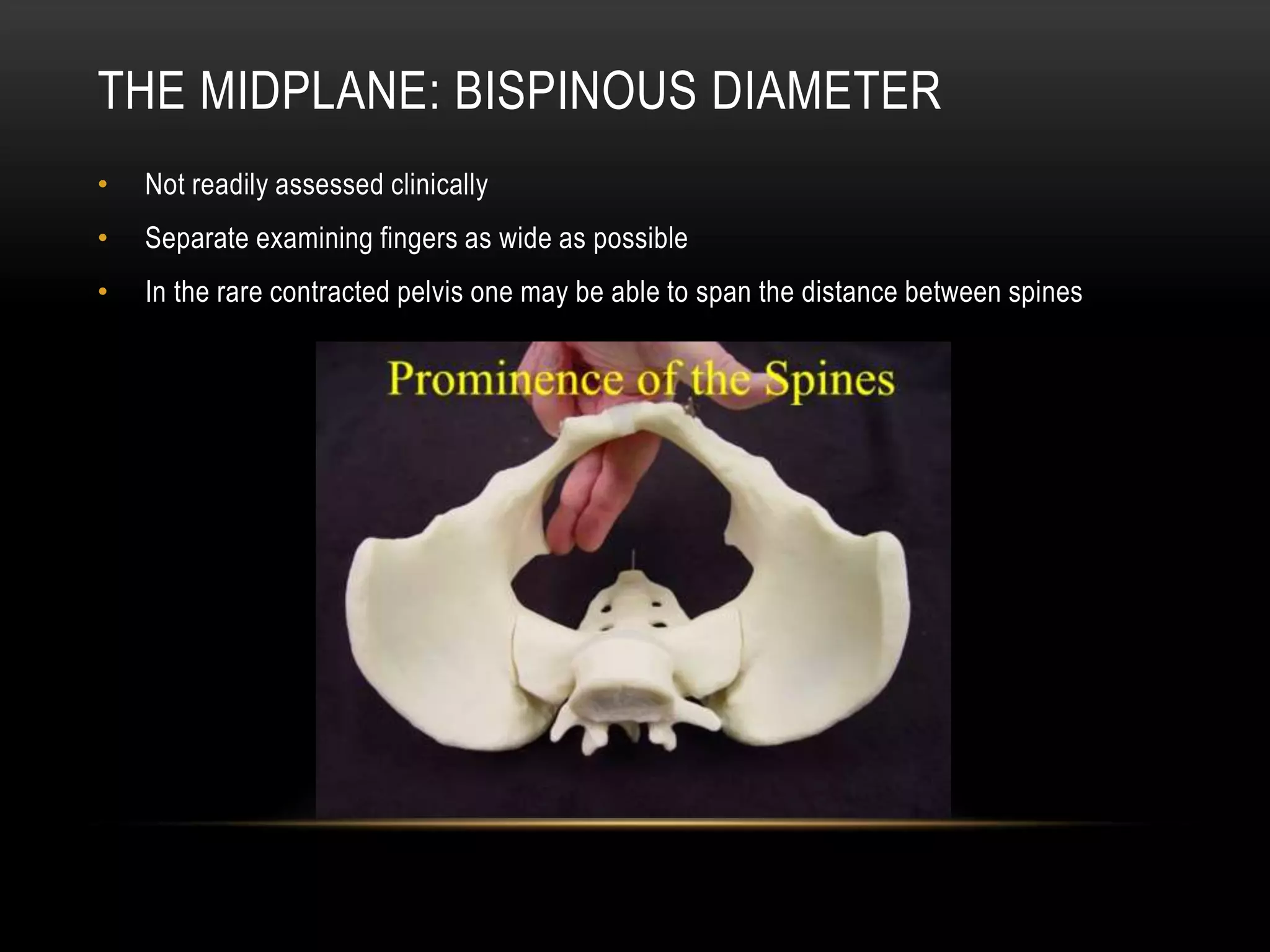 Clinical pelvimetry and Forceps Assisted Vaginal Delivery | PPTX