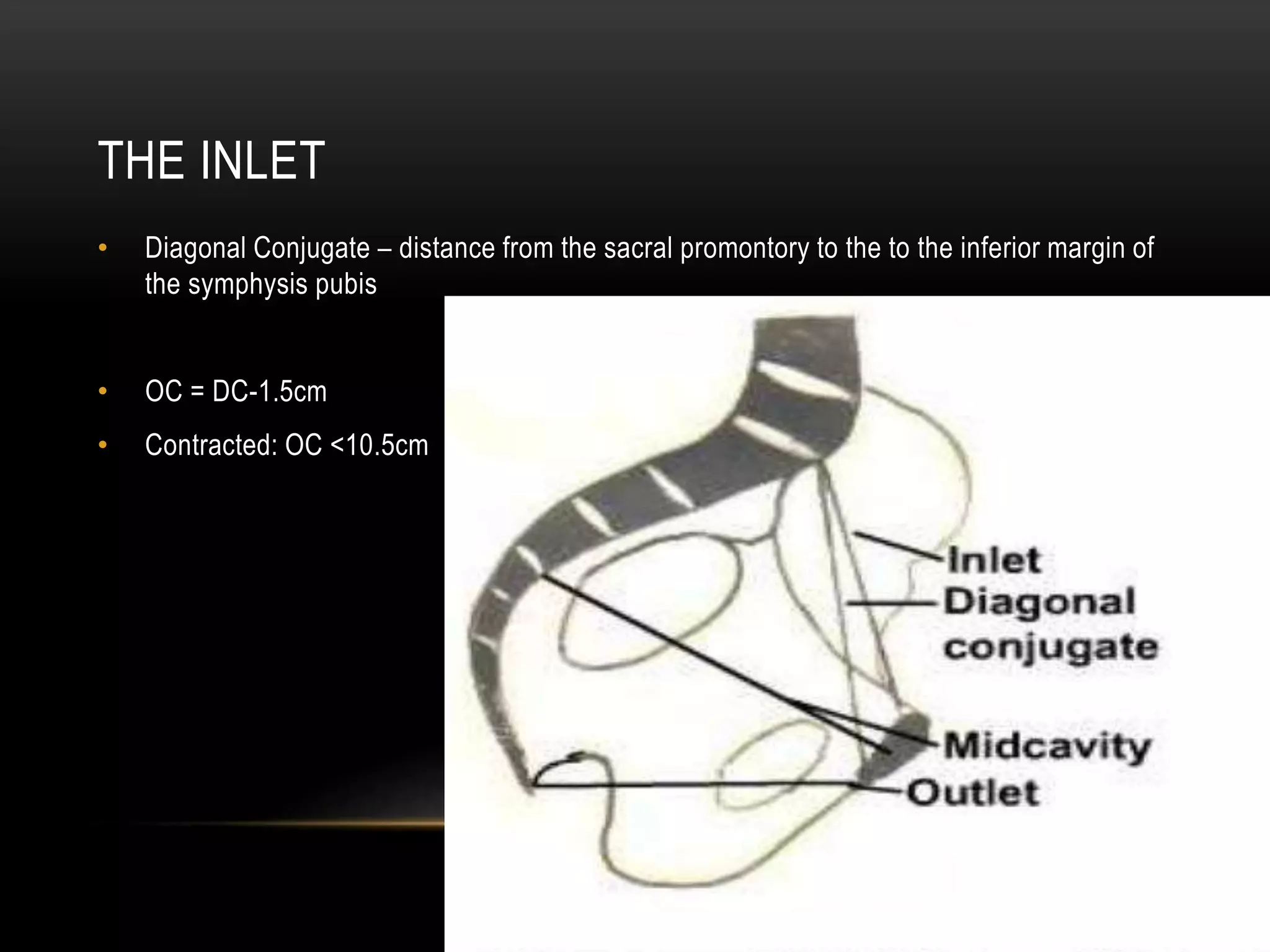 Clinical pelvimetry and Forceps Assisted Vaginal Delivery | PPT