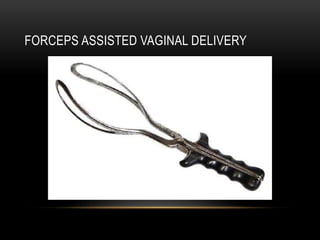 Clinical pelvimetry and Forceps Assisted Vaginal Delivery | PPTX