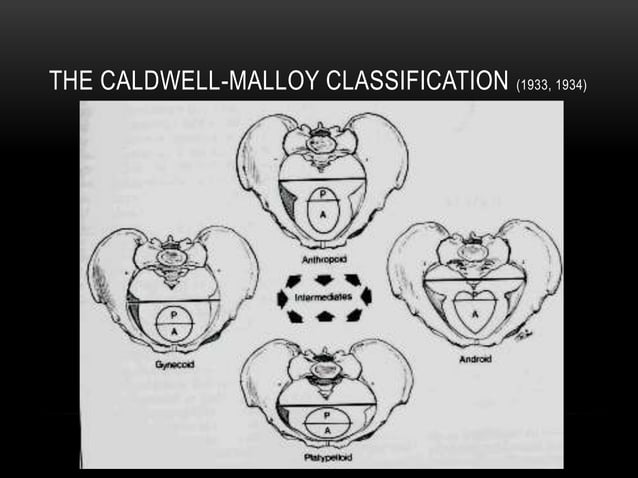 Clinical pelvimetry and Forceps Assisted Vaginal Delivery | PPTX