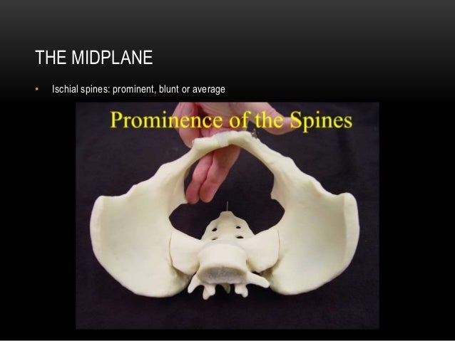 Clinical pelvimetry and Forceps Assisted Vaginal Delivery