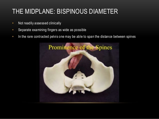 Clinical pelvimetry and Forceps Assisted Vaginal Delivery