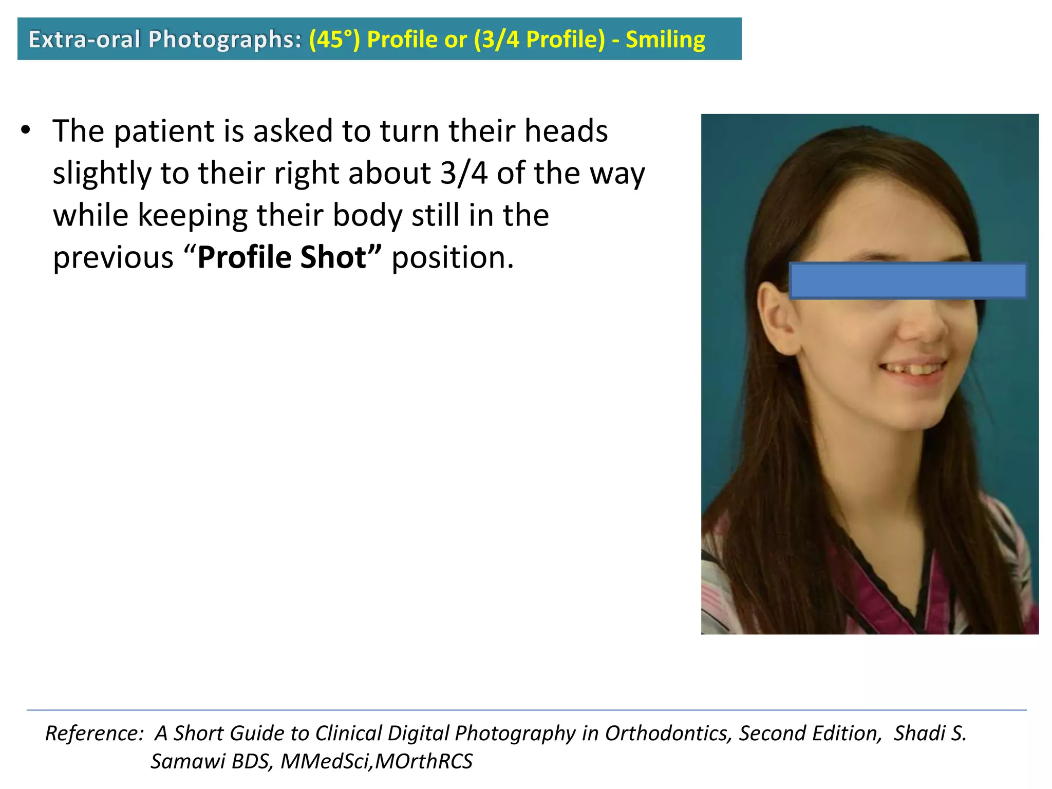 Clinical photography in Orthodontics | PPTX