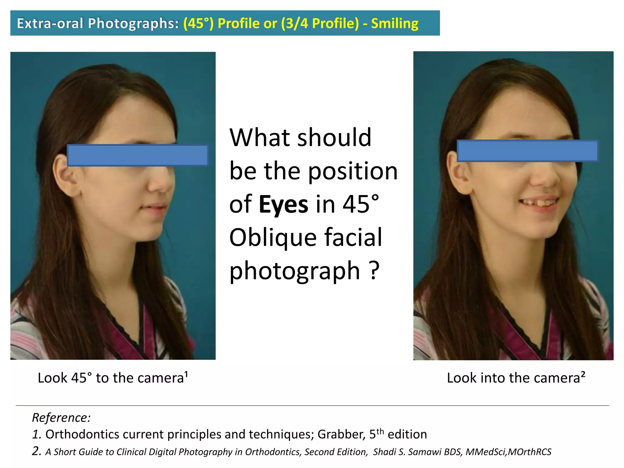 Clinical photography in Orthodontics | PPTX