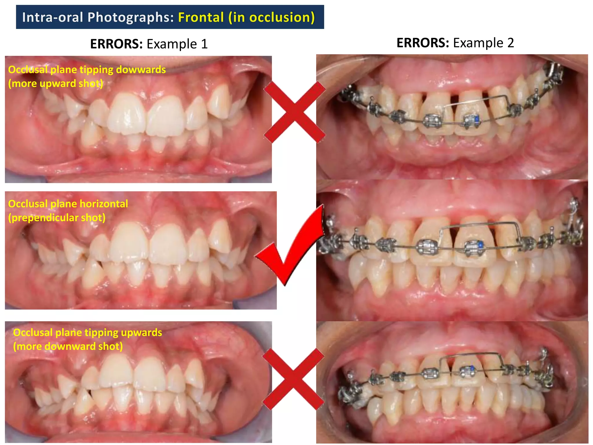 Clinical photography in Orthodontics | PPTX