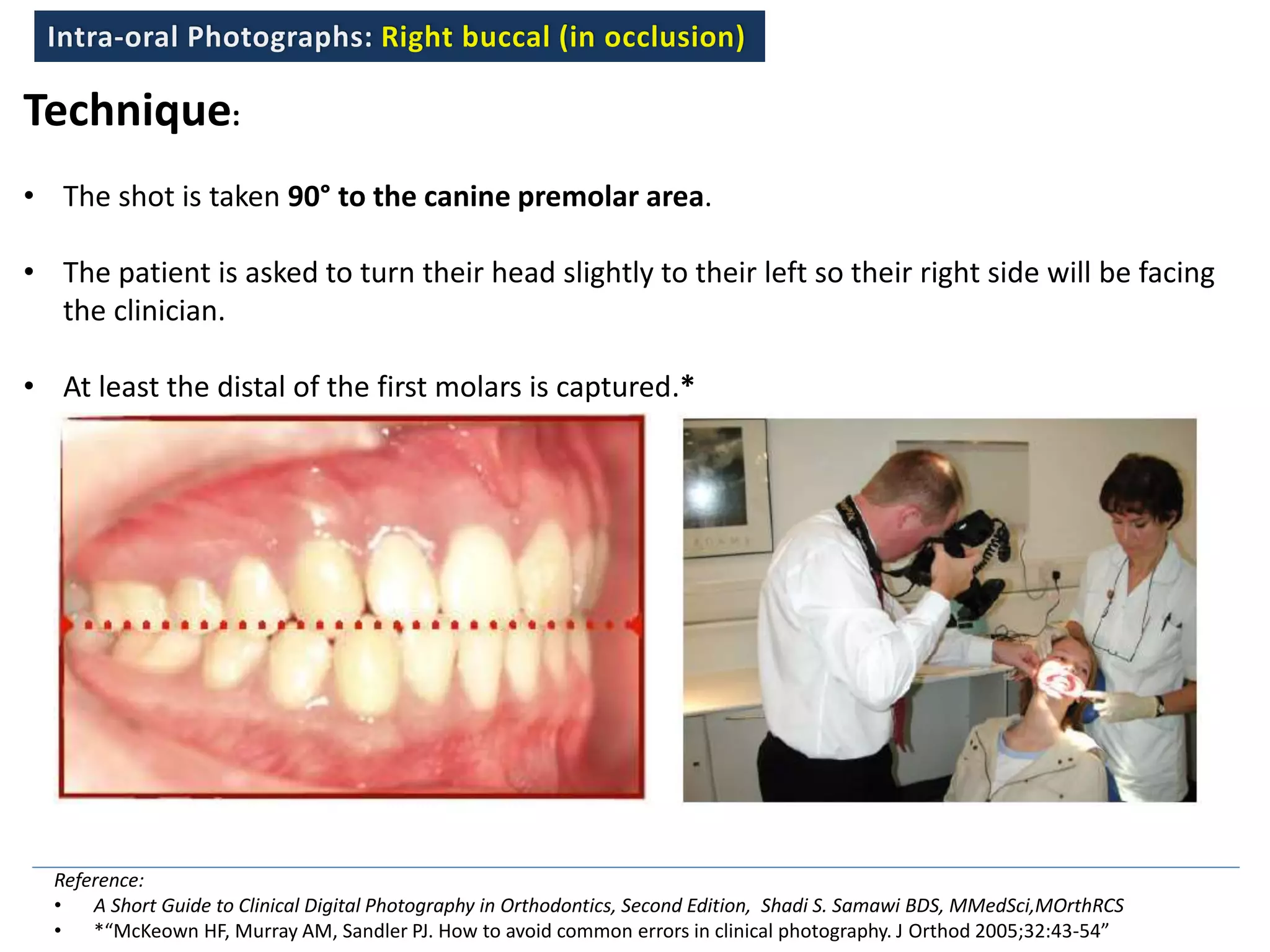 Clinical photography in Orthodontics | PPTX
