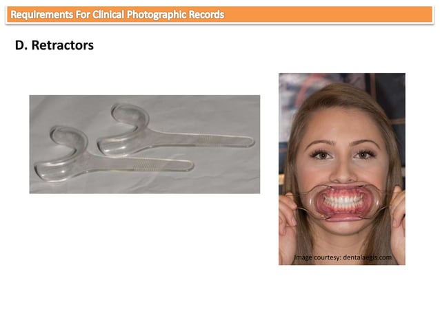 Clinical photography in Orthodontics | PPTX
