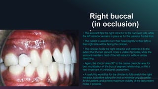 Clinical photography in orthodontics | PPTX