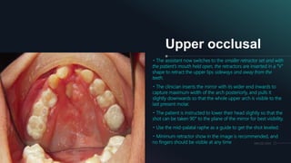 Clinical photography in orthodontics | PPTX