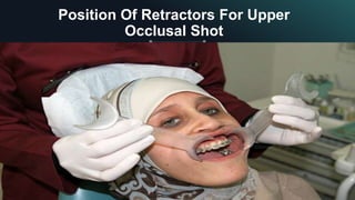 Clinical photography in orthodontics | PPTX