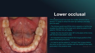 Clinical photography in orthodontics | PPTX