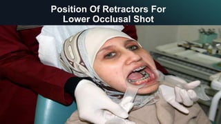 Clinical photography in orthodontics | PPTX