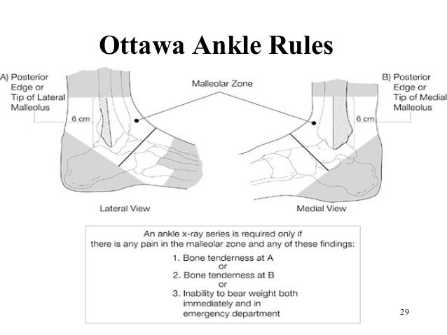 Clinical Prediction Rules