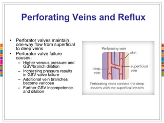 Venous Insufficiency | PPT