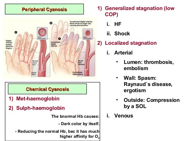Clinical Diagnosis of Respiratory Diseases