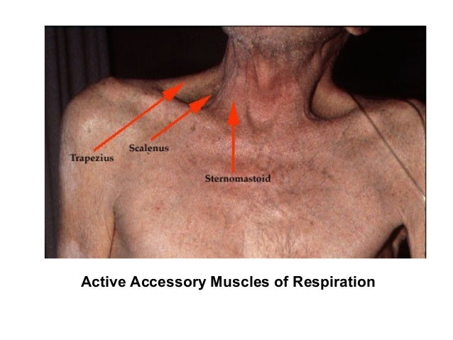 Clinical Diagnosis of Respiratory Diseases