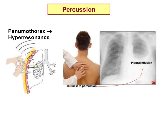 Clinical Diagnosis of Respiratory Diseases