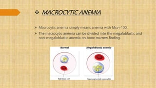 Clinical Presentation Of Megaloblastic Anemia.pptx | Blood Disorders ...