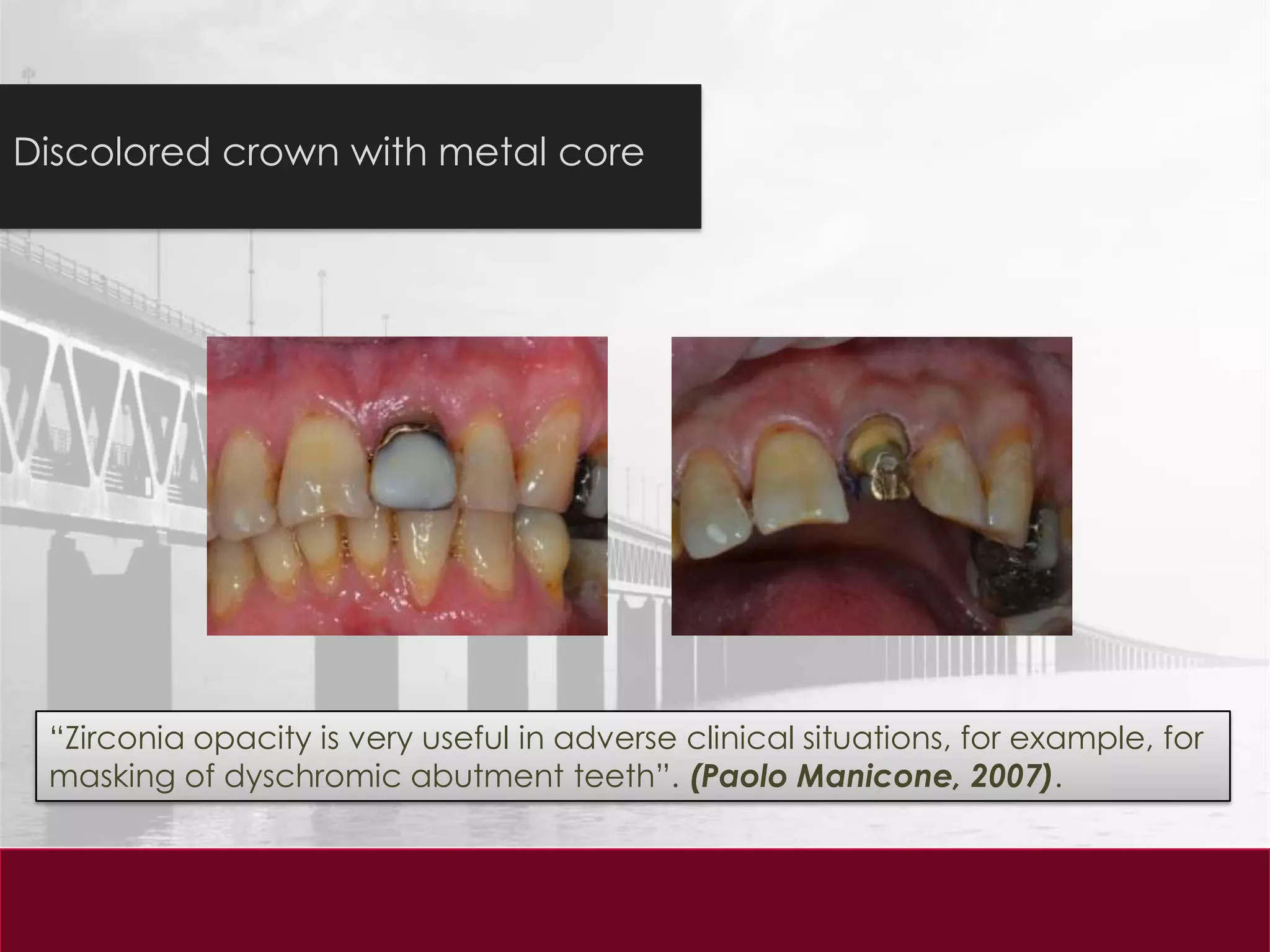 Dental clinical case presentation | PPTX