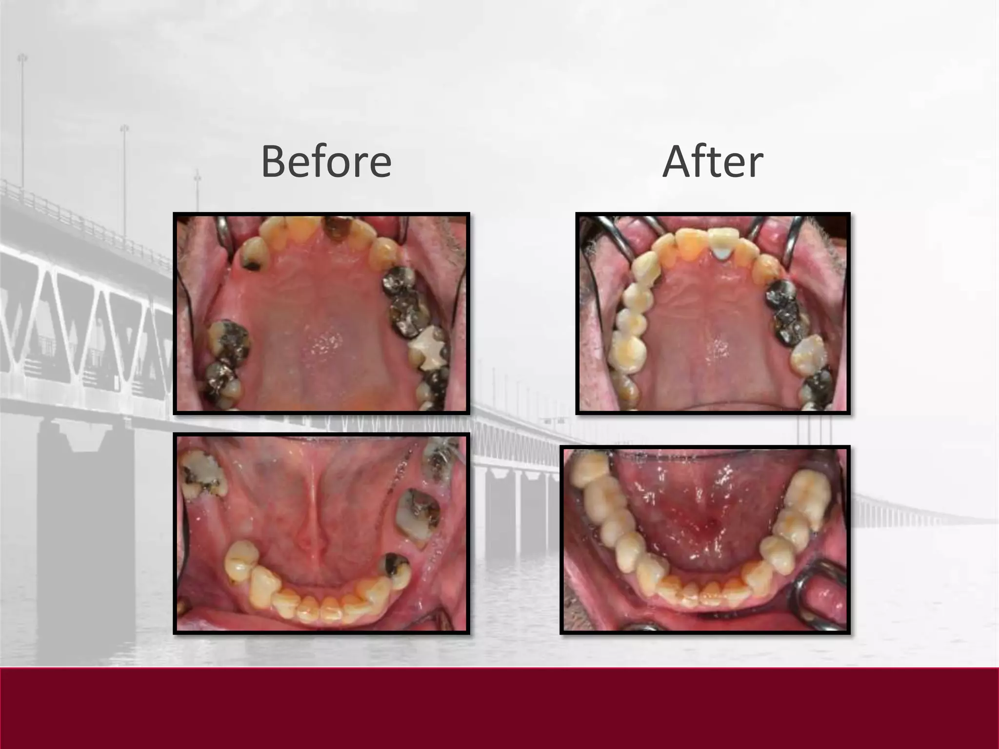 Dental clinical case presentation | PPTX