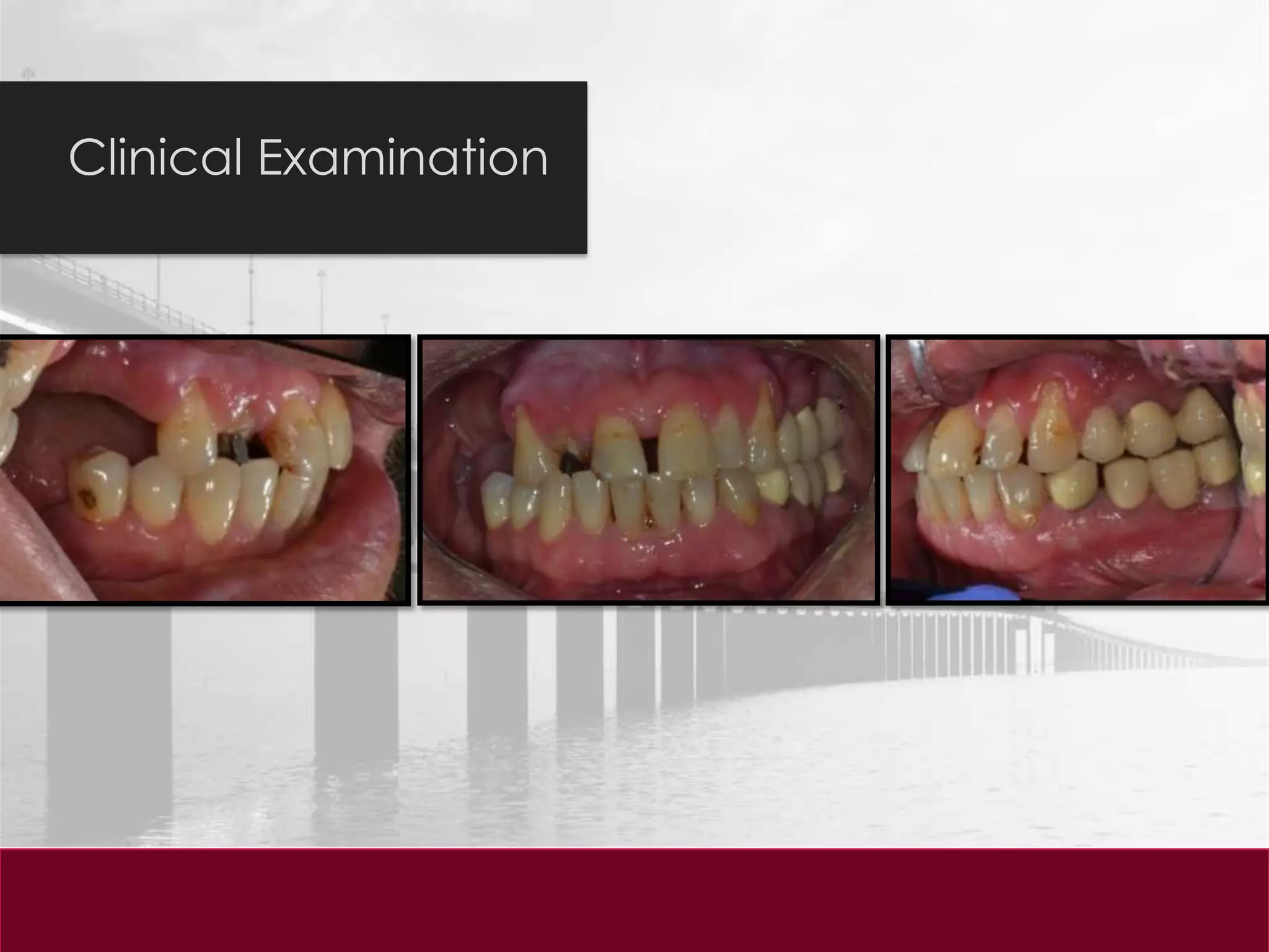 Dental clinical case presentation | PPTX