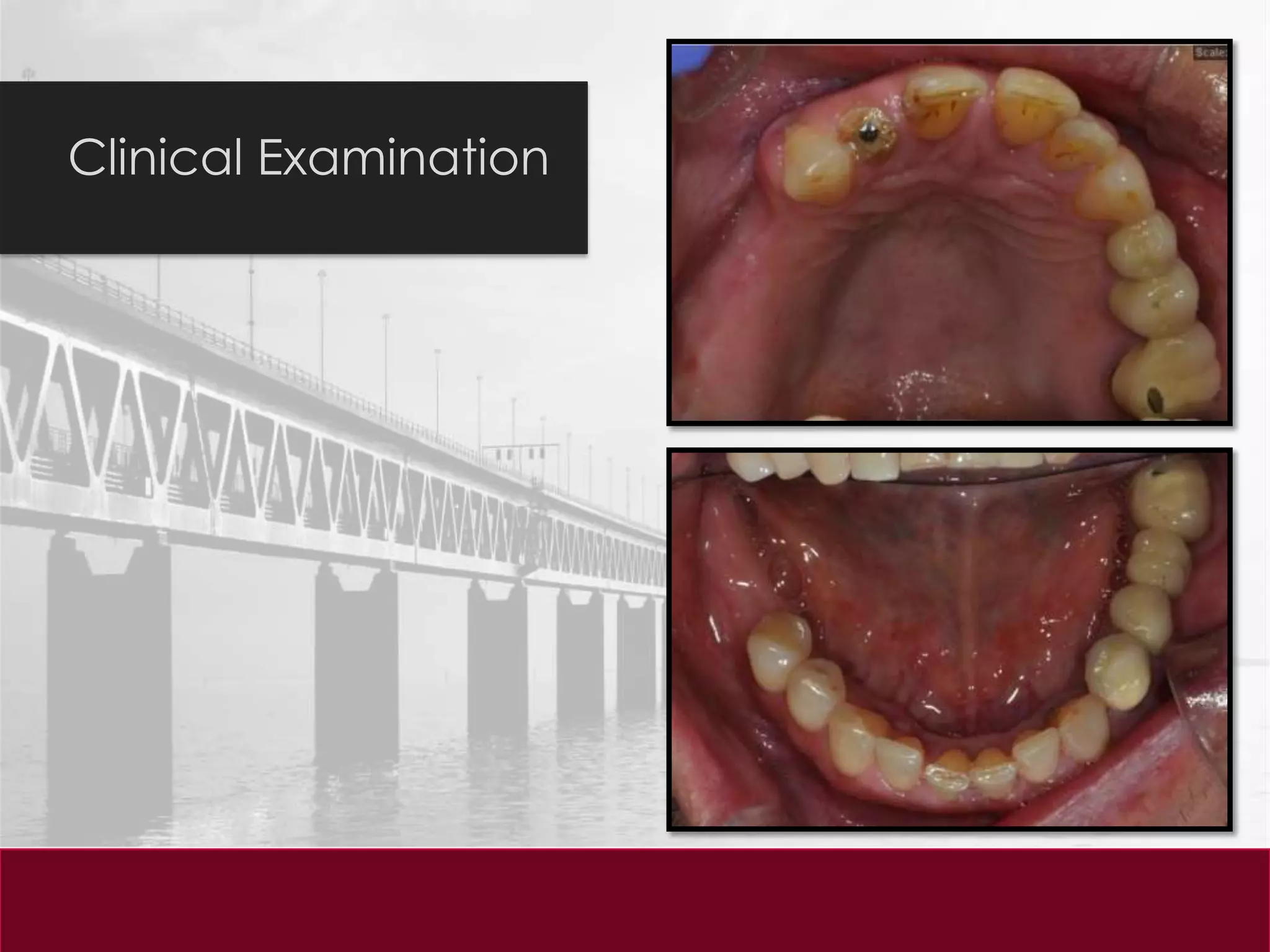 Dental clinical case presentation | PPTX