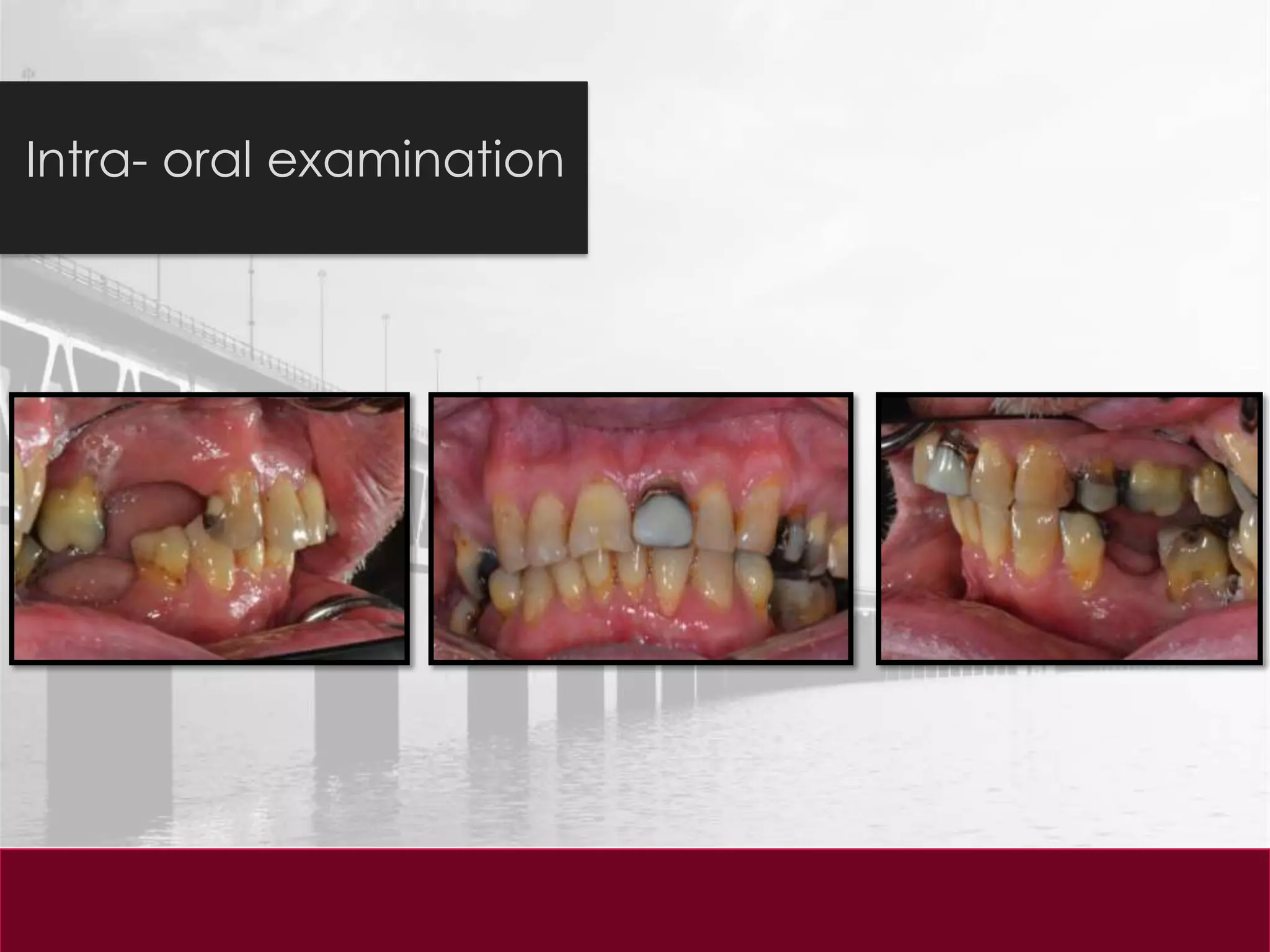 Dental clinical case presentation | PPTX
