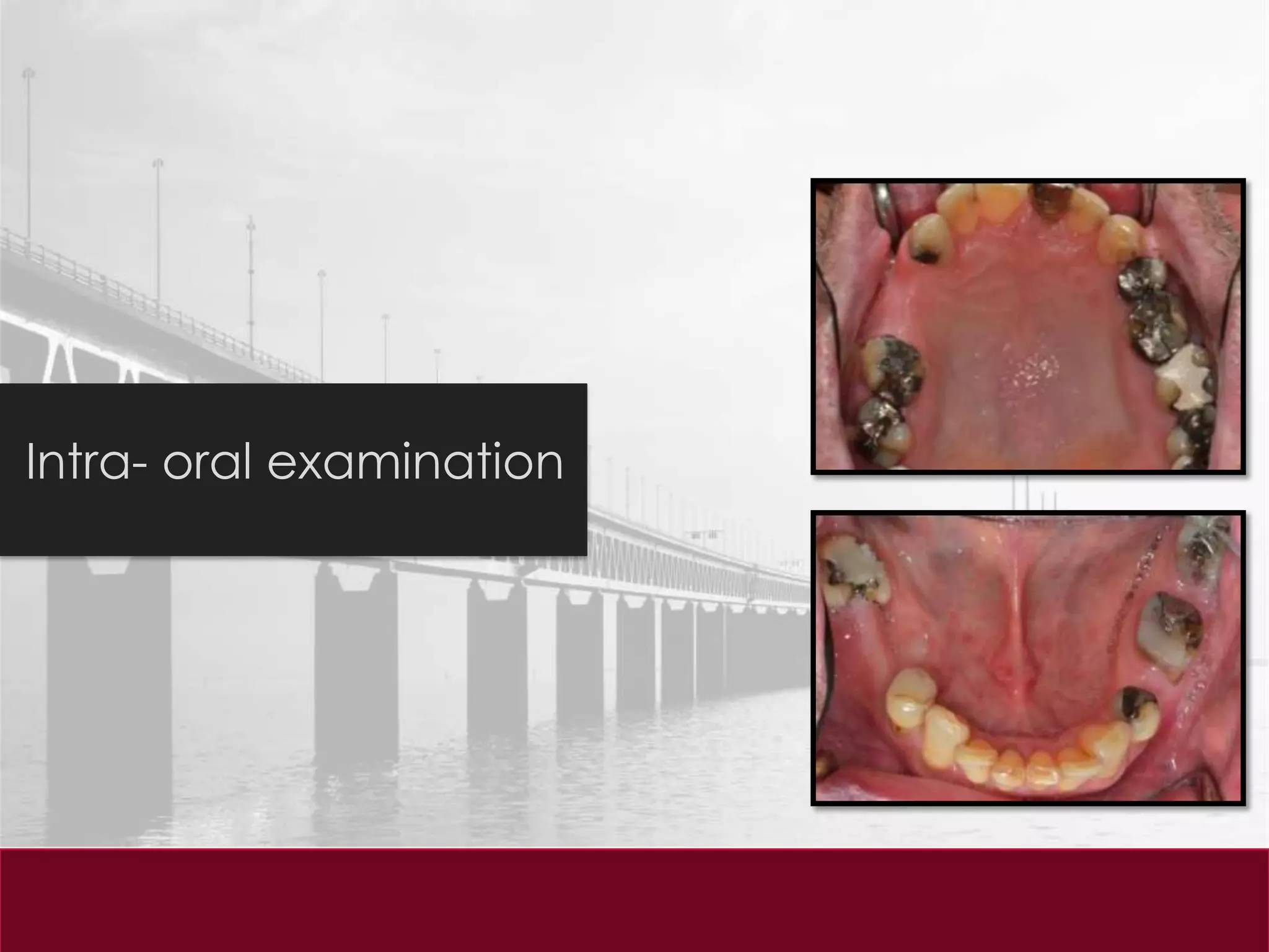 Dental clinical case presentation | PPTX
