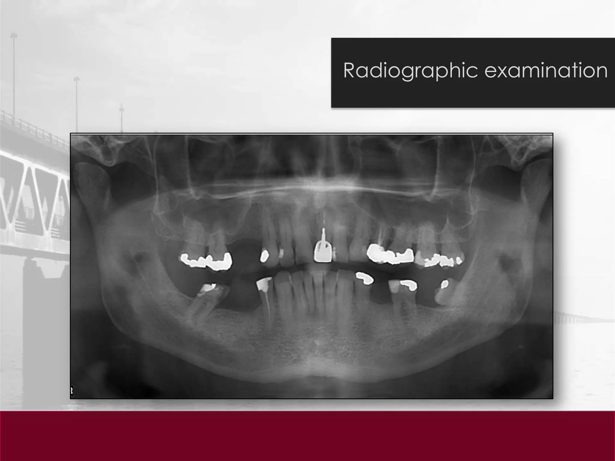 Dental clinical case presentation | PPTX