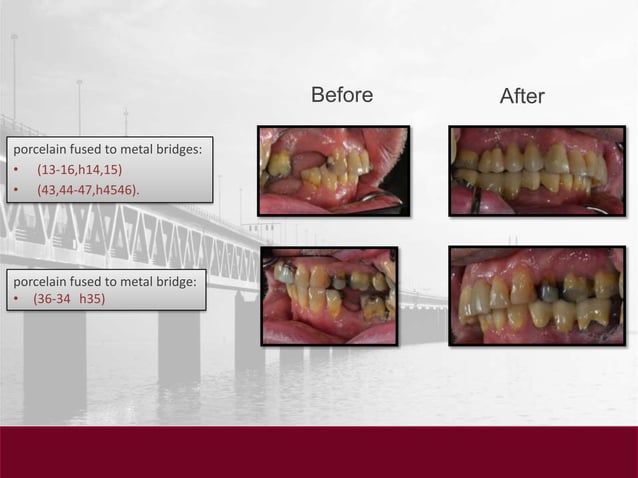 Dental clinical case presentation | PPTX | Oral care | Personal Care