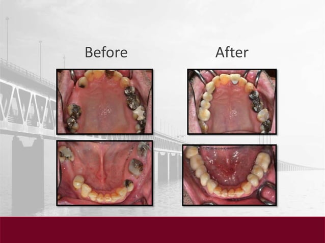 Dental clinical case presentation | PPTX | Oral care | Personal Care