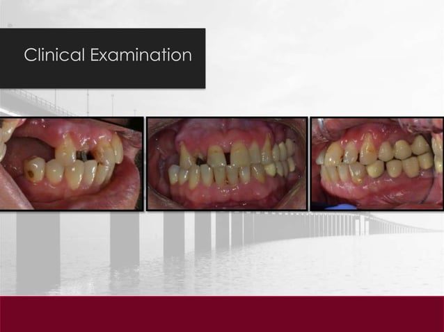 Dental clinical case presentation | PPTX | Oral care | Personal Care