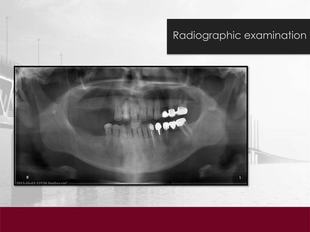Dental clinical case presentation | PPTX | Oral care | Personal Care