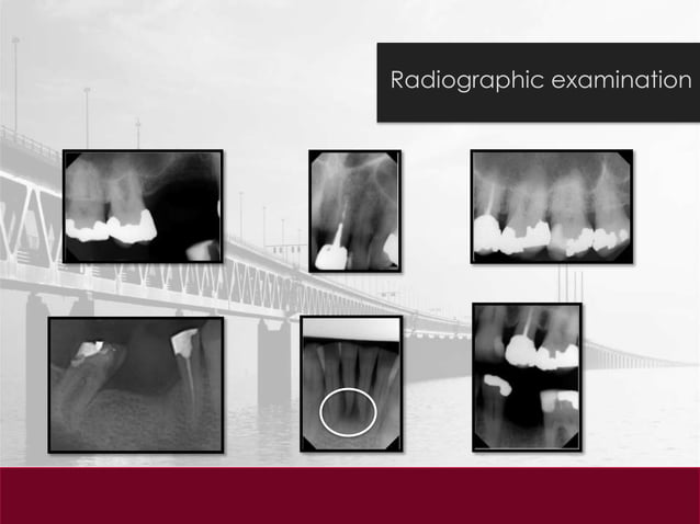 Dental clinical case presentation | PPTX | Oral care | Personal Care