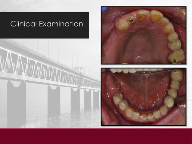 Dental clinical case presentation | PPT