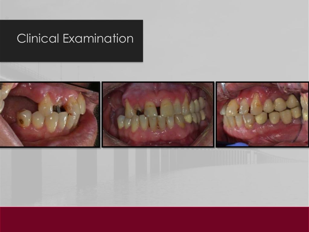 Dental clinical case presentation