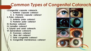 CLINICAL Presentaton OF CATARACTS-4.pptx