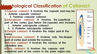 CLINICAL Presentaton OF CATARACTS-4.pptx