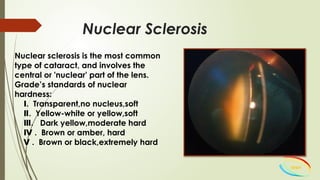 CLINICAL Presentaton OF CATARACTS-4.pptx