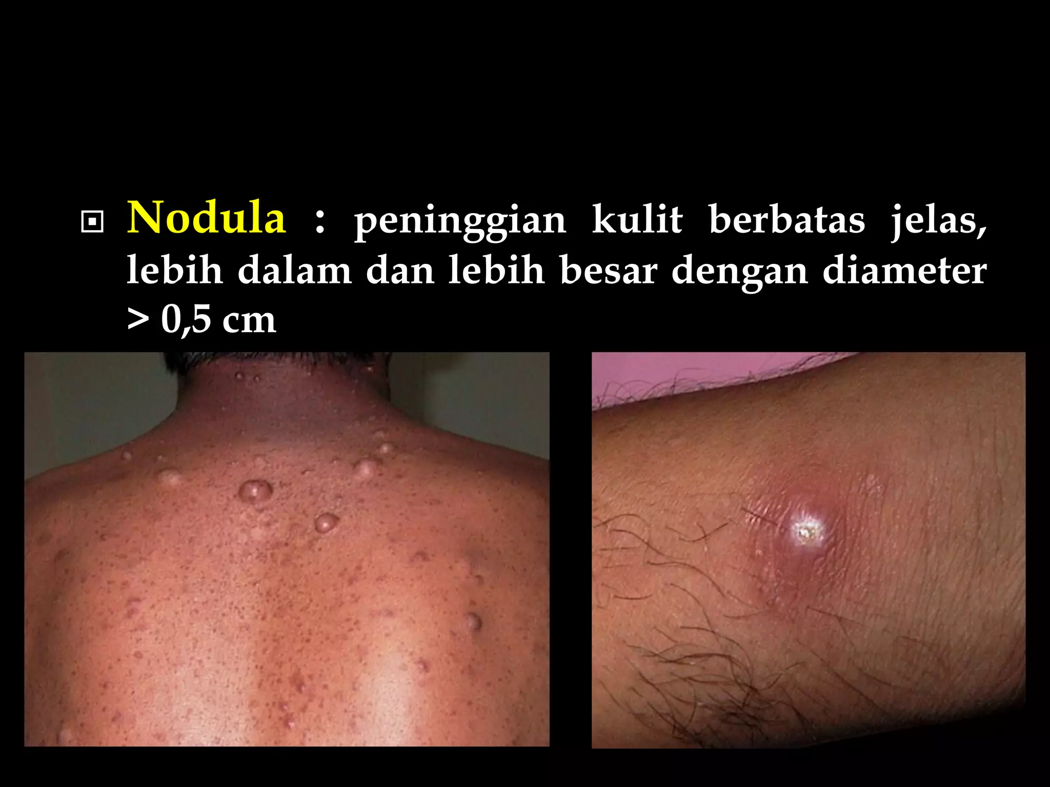Clinical process dermatoveneorology | PDF