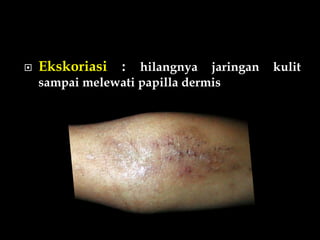Clinical process dermatoveneorology | PPT