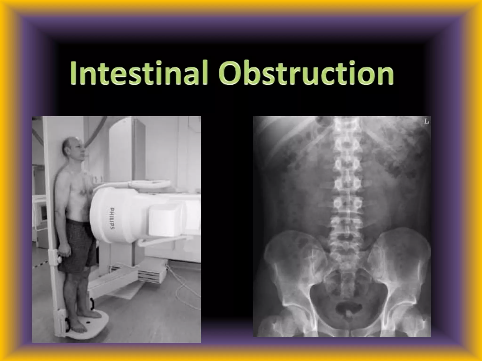 Clinical radiography for emergency doctors soft tissue organs trauma | PPT