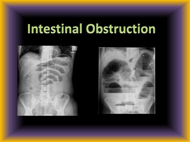 Clinical radiography for emergency doctors soft tissue organs trauma | PPT