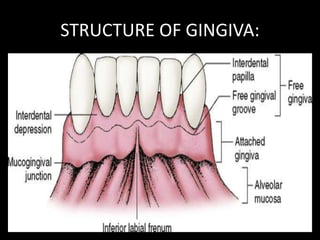 Clinical reatures of gingivitis | PPTX